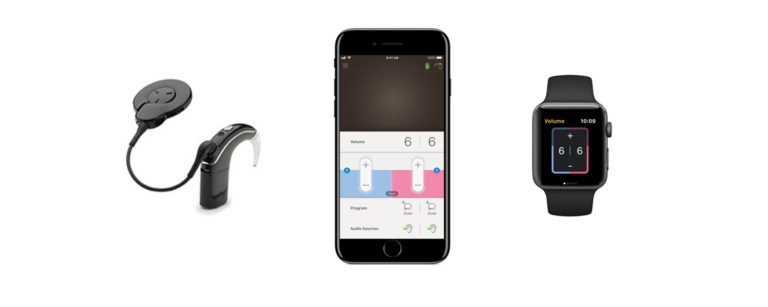 More control, now on your wrist - Cochlear Family News